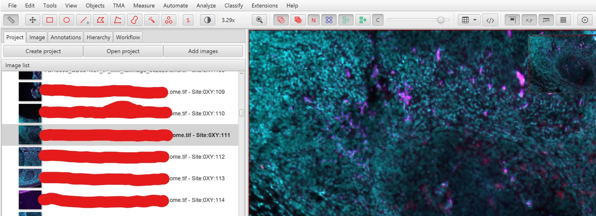 OME-tiff file opening as individual images - Image Analysis - Image.sc Forum