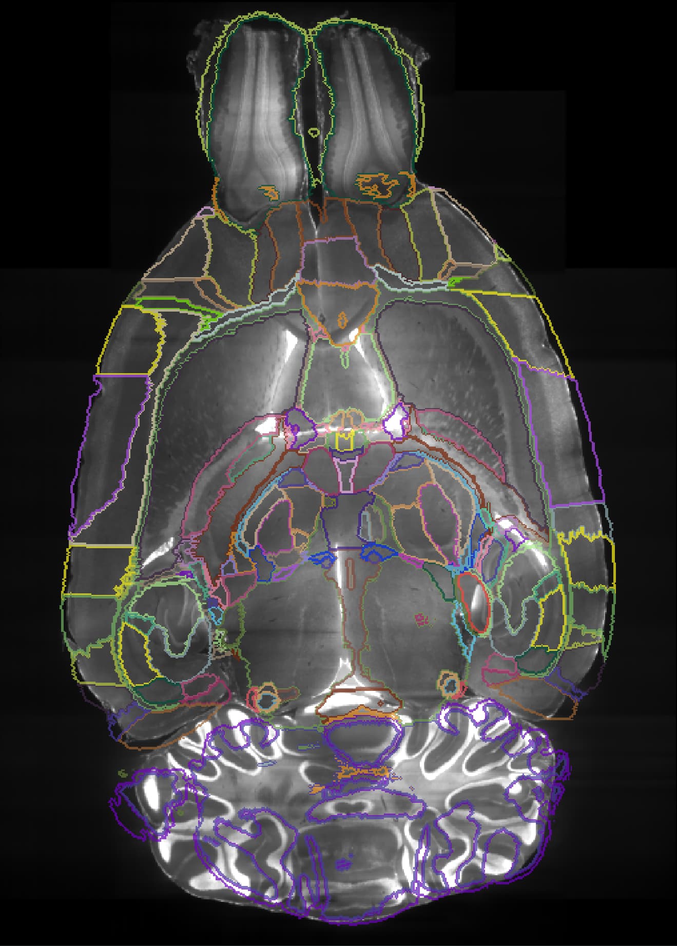 Optimizing a BrainReg fit - Image Analysis - Image.sc Forum