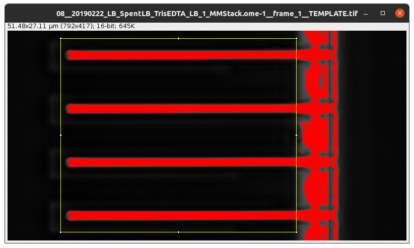 How to threshold an image only within a ROI/selection using ImageJ - Usage & Issues - Image.sc Forum