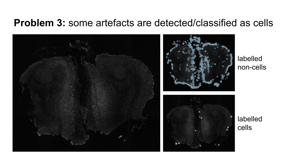 Advice on optimising cellfinder detection parameters - Usage & Issues - Image.sc Forum