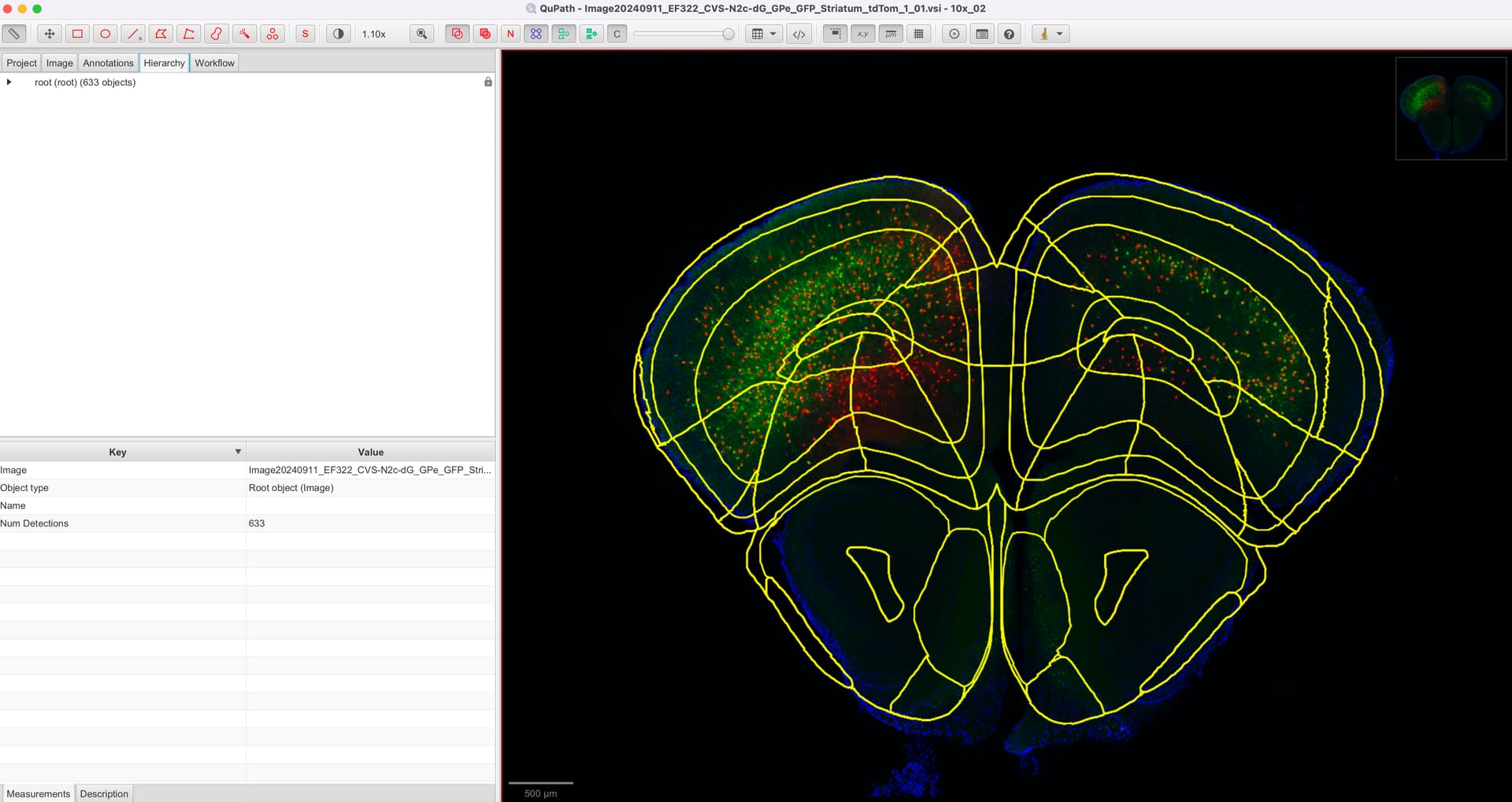 Issue with ABBA brain atlas registration to QuPath cell detection pipeline: detected cells won't ...