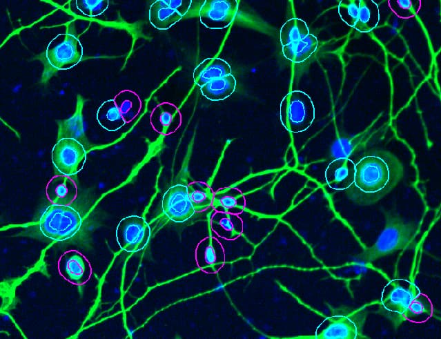 Segmenting neurons and other cells - Image Analysis - Image.sc Forum