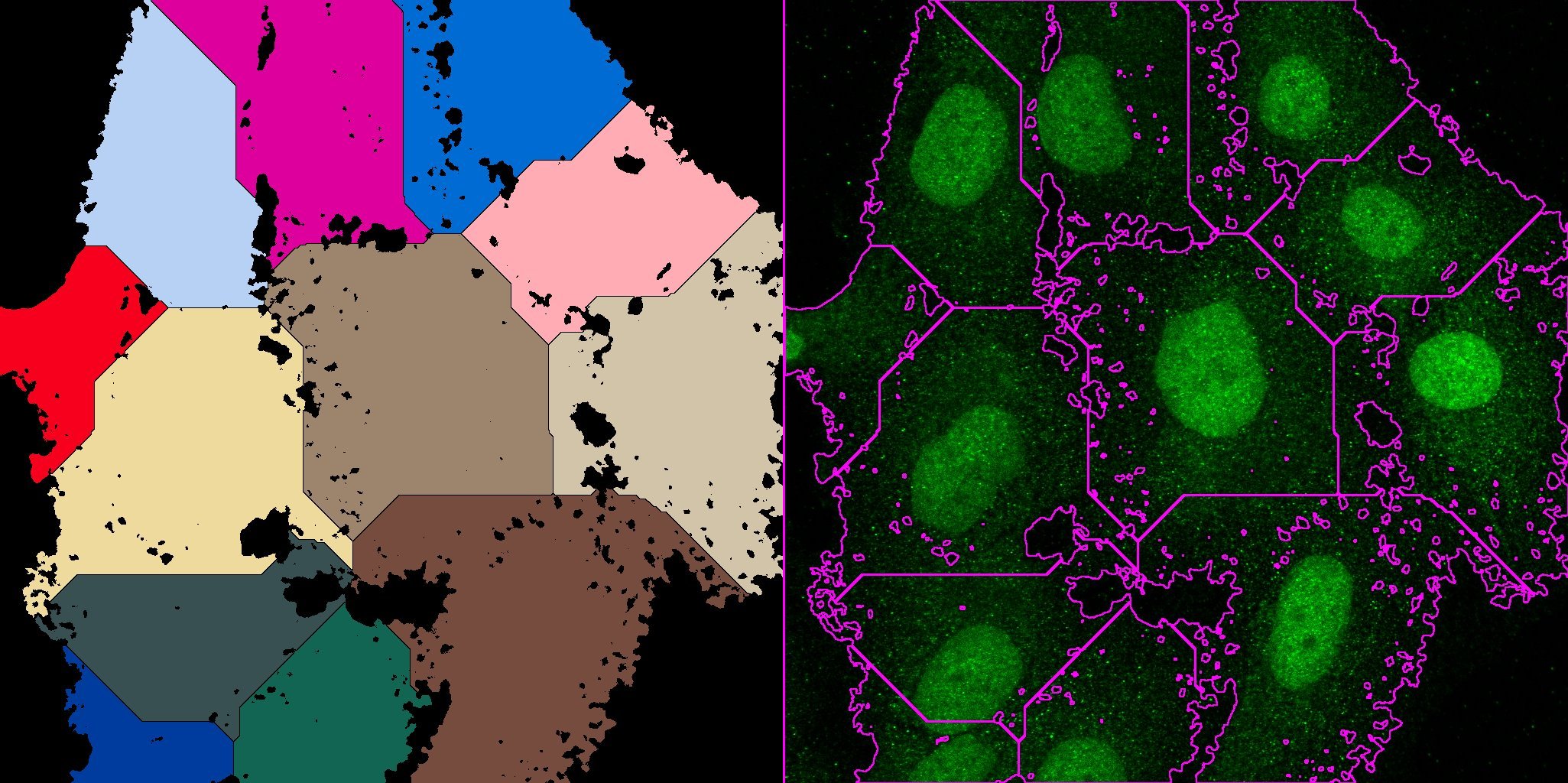 Patch processing ImageJ script for determining nucleus/cytoplasm ratio - Image Analysis - Image ...