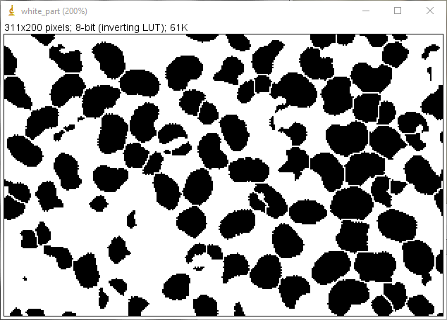Image segmentation using imageJ - Image Analysis - Image.sc Forum