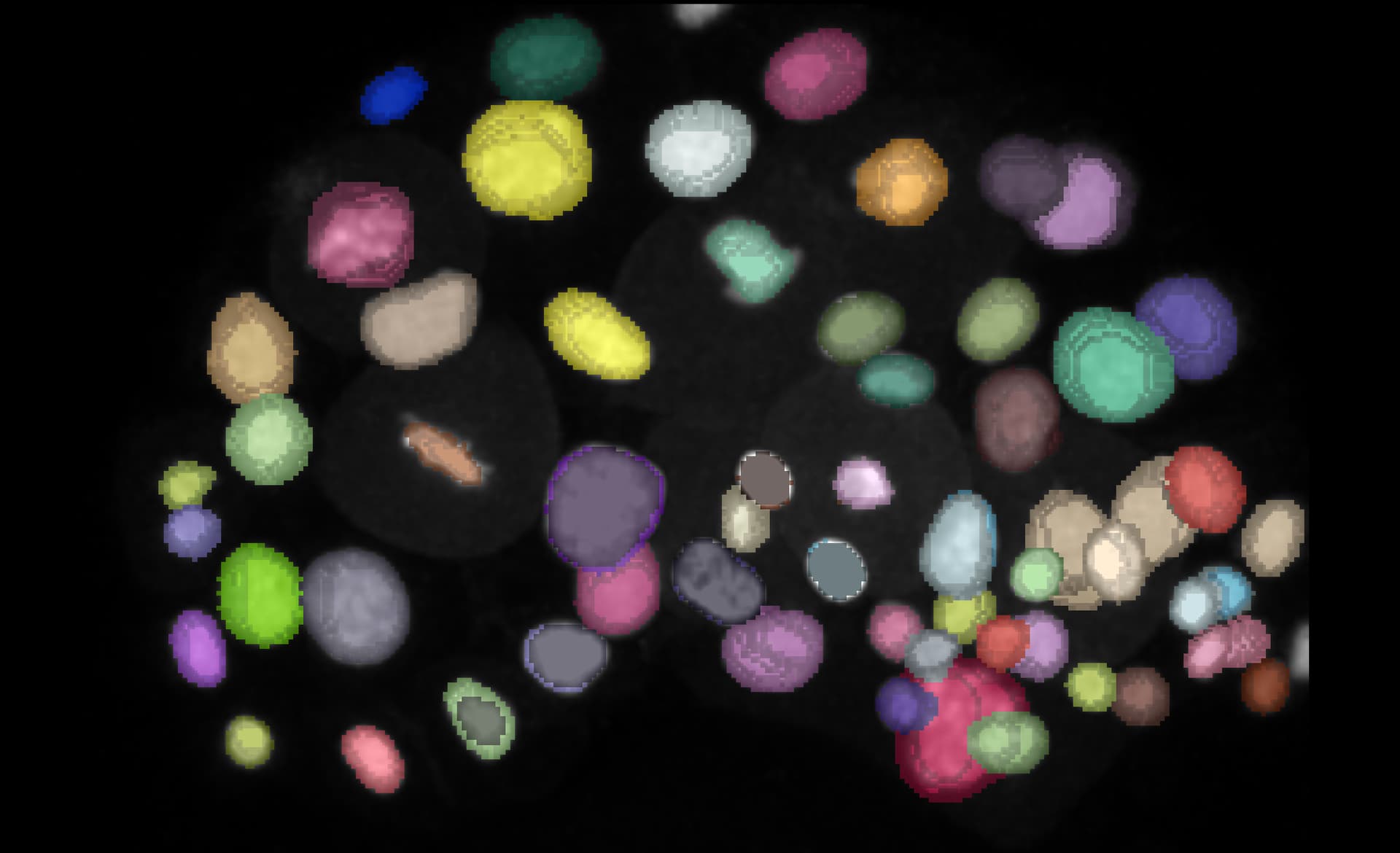 Using pretrained stardist 2D model for training of a stardist 3D model ...