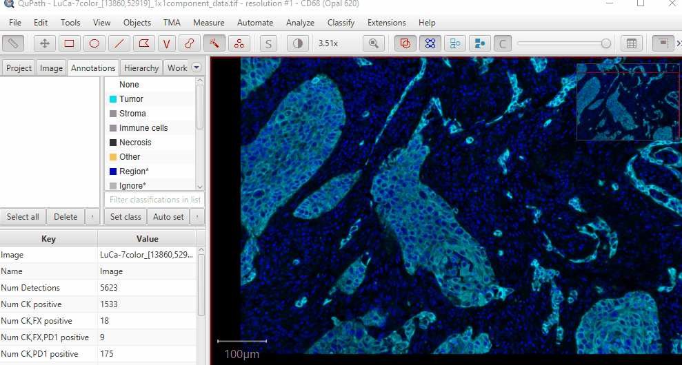 Sorting results according to ROIs in ImageJ - Image Analysis - Image.sc Forum