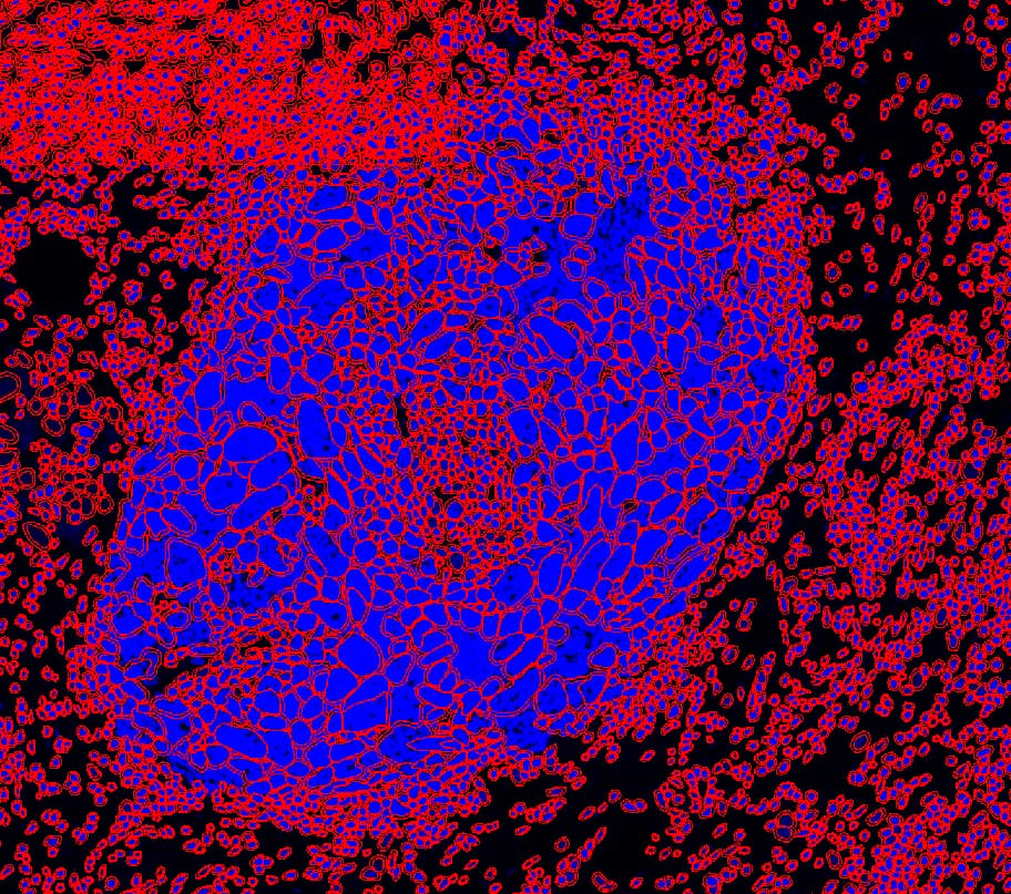 Difficult segmentation, IF, Lymph node - Image Analysis - Image.sc Forum