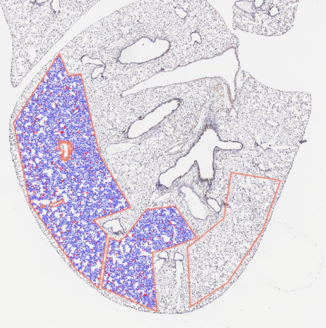 Qupath Does Not Select All Annotations When Using Selectannotations Image Analysis Image