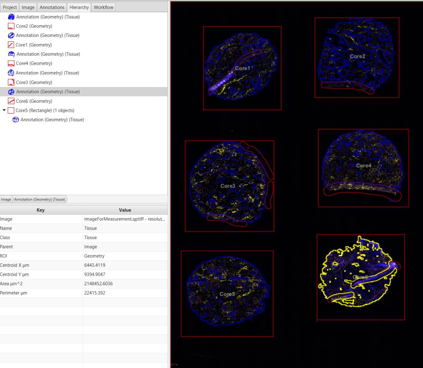 QuPath Resolve Hierarchy Geometry Annotation type - Image Analysis - Image.sc Forum