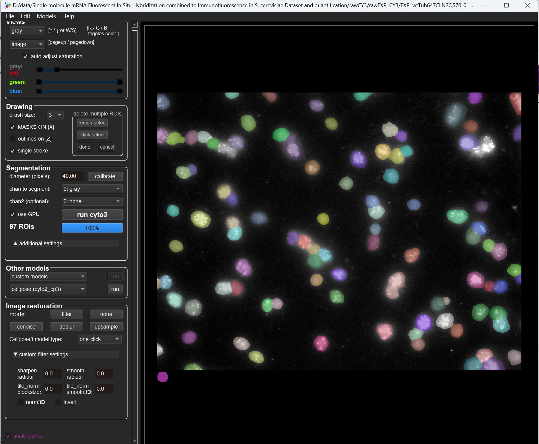 How to Better Segment Fluorescent Cells and Spots in CellProfiler - Image Analysis - Image.sc Forum