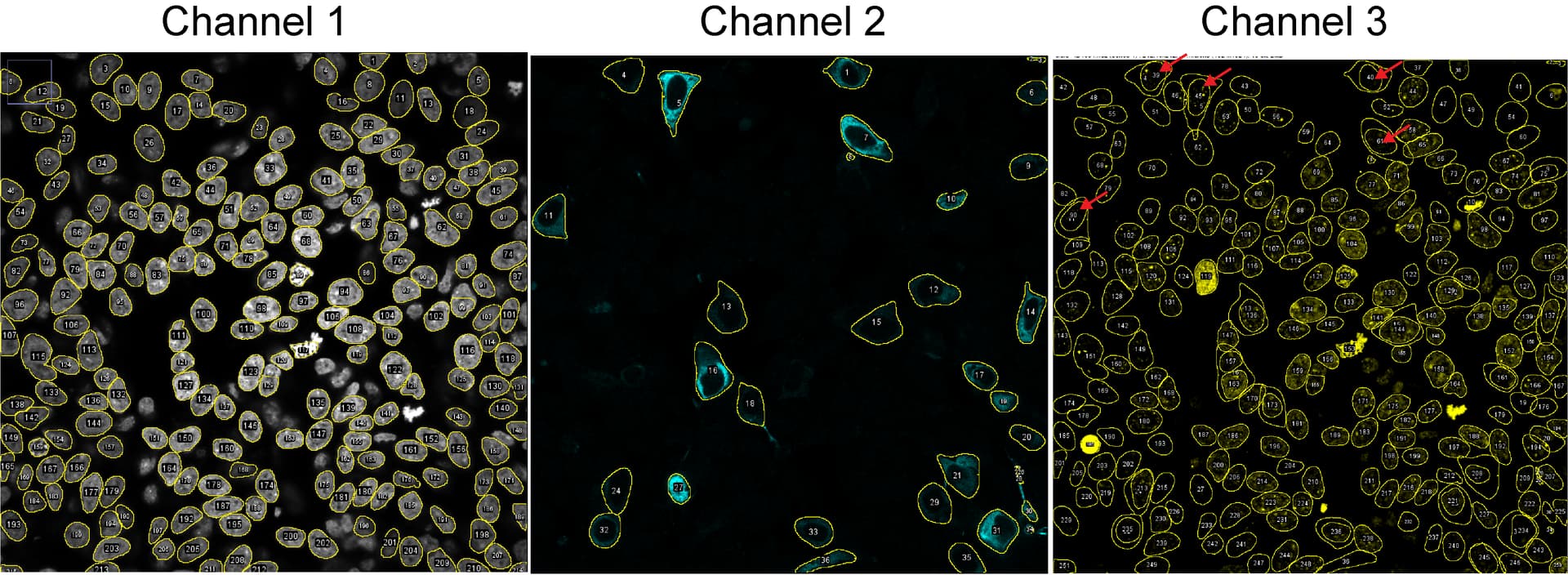 Can different ROIs from two different channels be overlayed? - Image Analysis - Image.sc Forum