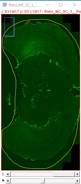 StarDist segmentation with large background pixels - Usage & Issues - Image.sc Forum