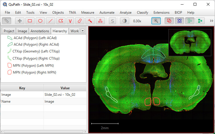 QuPath script to restrict cell detection to several sub-regions of the brain - Image Analysis ...
