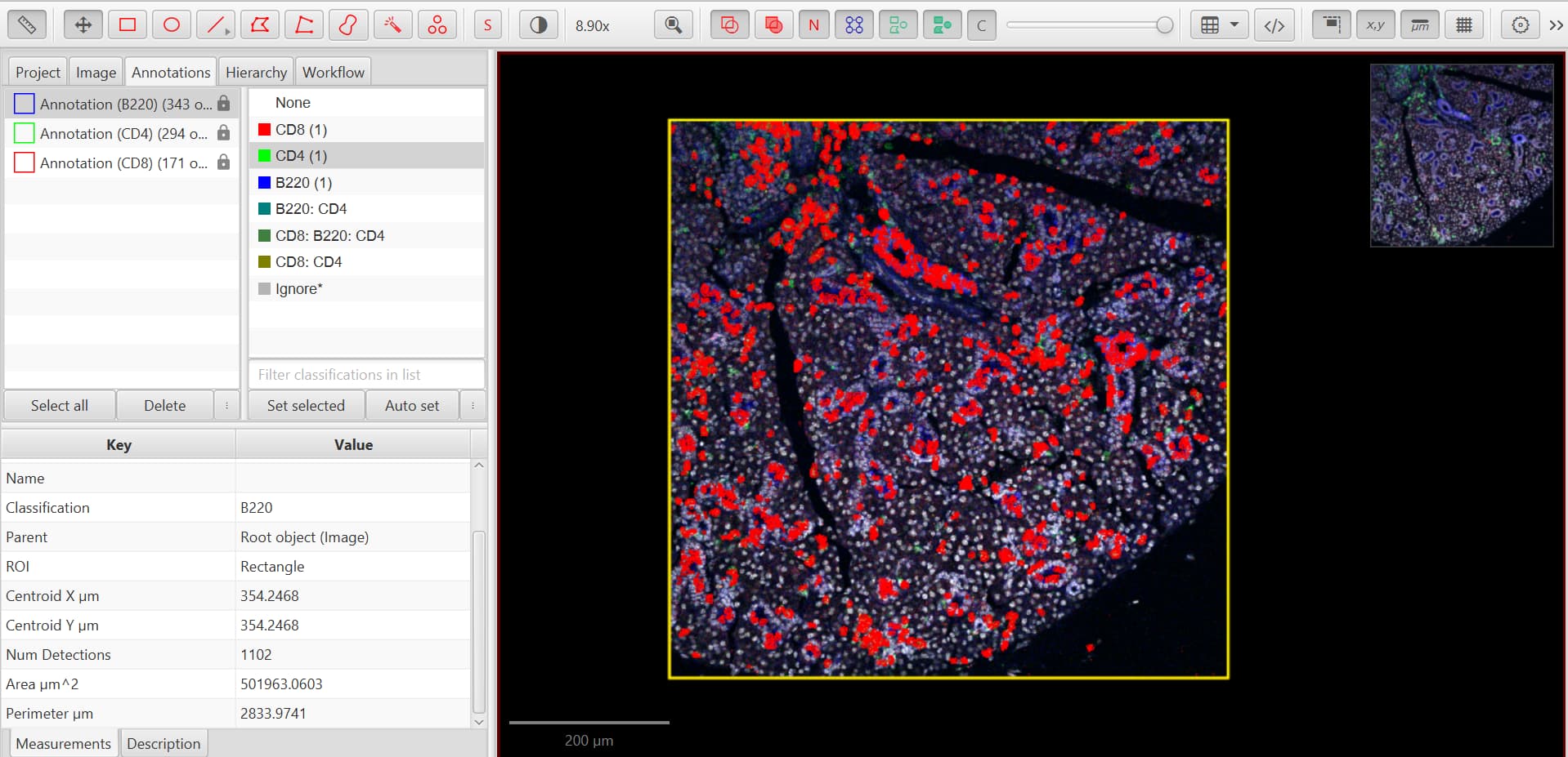 Changing color of detections of multiple cell/stain types - Image Analysis - Image.sc Forum