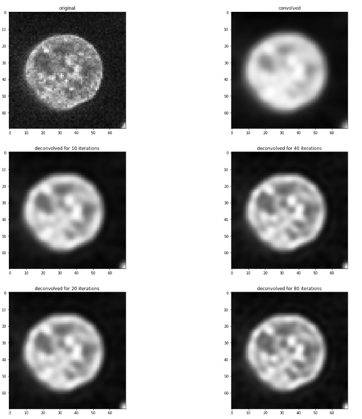 Skimage RichardsonLucy Deconvolutation - Image Analysis - Image.sc Forum