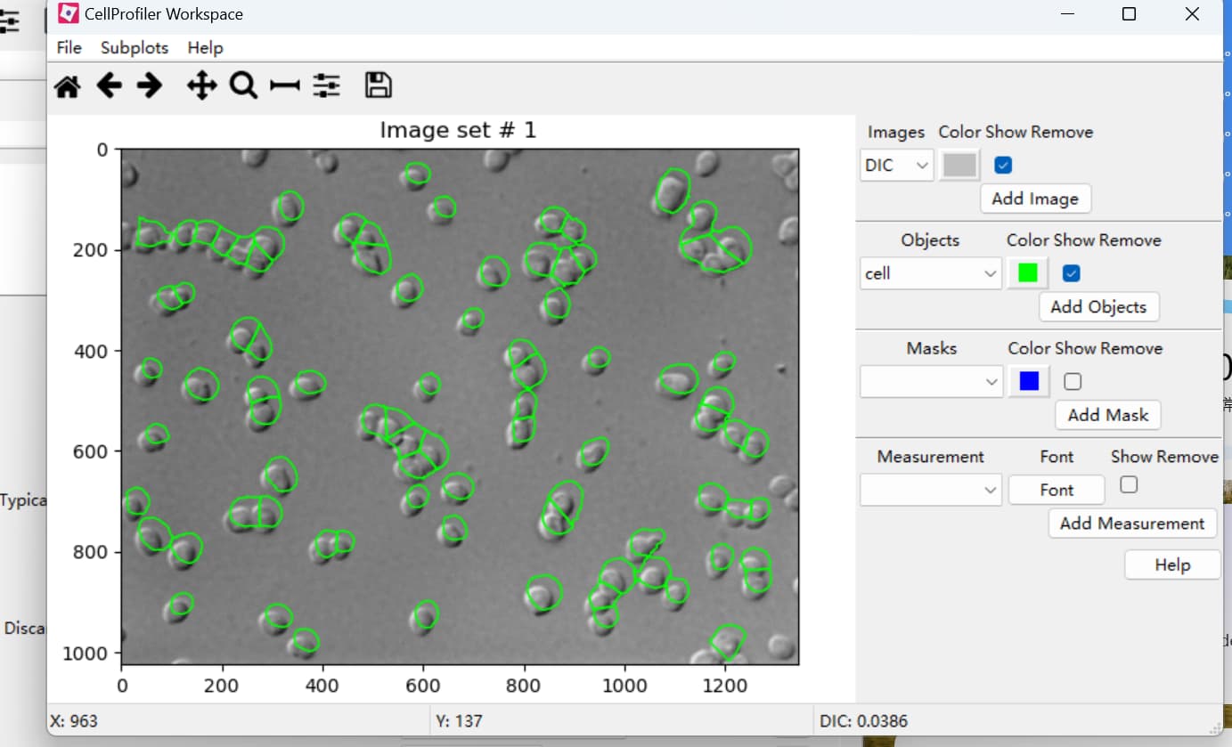 How to Better Segment Fluorescent Cells and Spots in CellProfiler - Image Analysis - Image.sc Forum