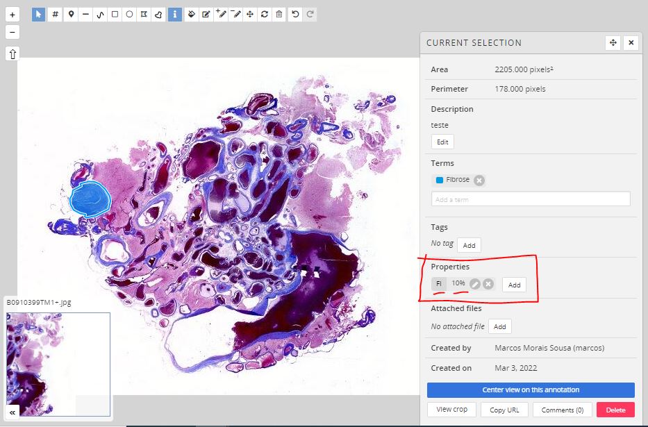 How to get properties (key and value) of an annotation via API client ...