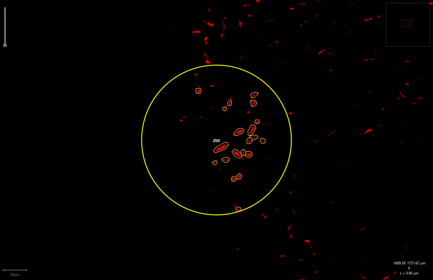 Cell Detection With Stardist On 2d Stack Images Usage And Issues Image Sc Forum