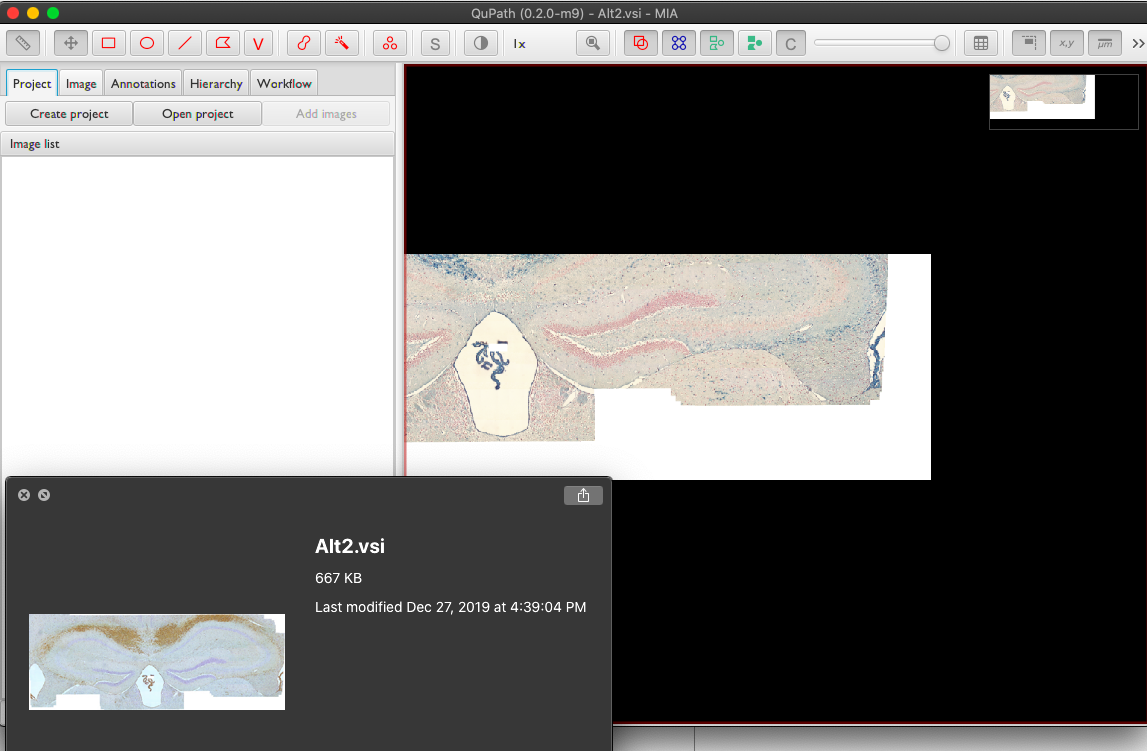 Importing a .vsi composite-image in ImageJ via bioformats-plugin - how do I get a high ...