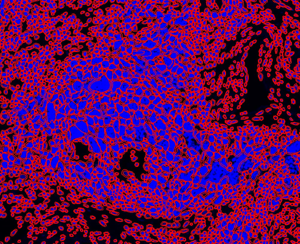 Difficult segmentation, IF, Lymph node - Image Analysis - Image.sc Forum