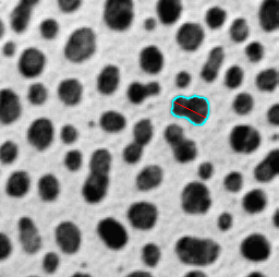 How to Apply the 'DrawFeretDiameter' Macro - Image Analysis - Image.sc ...