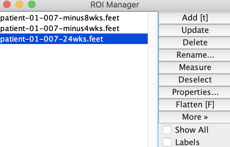 How To Loop Through Roisetzip In Imagej Macro Image Analysis Imagesc Forum