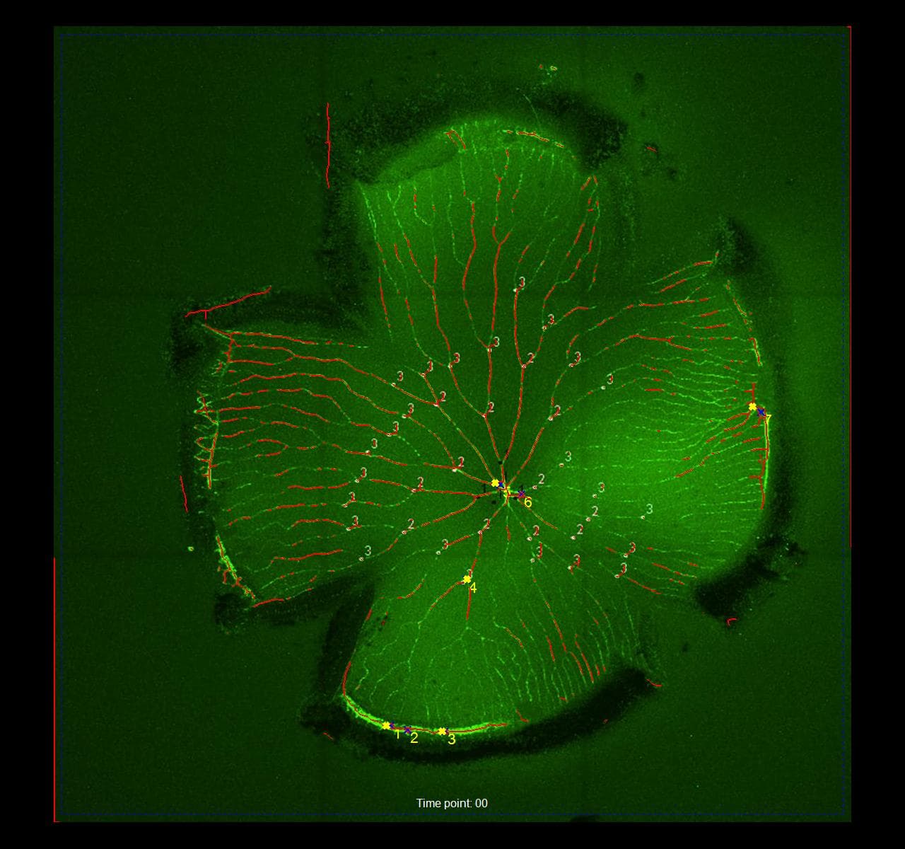 Help with skeleton analysis for retina images - Image Analysis - Image ...
