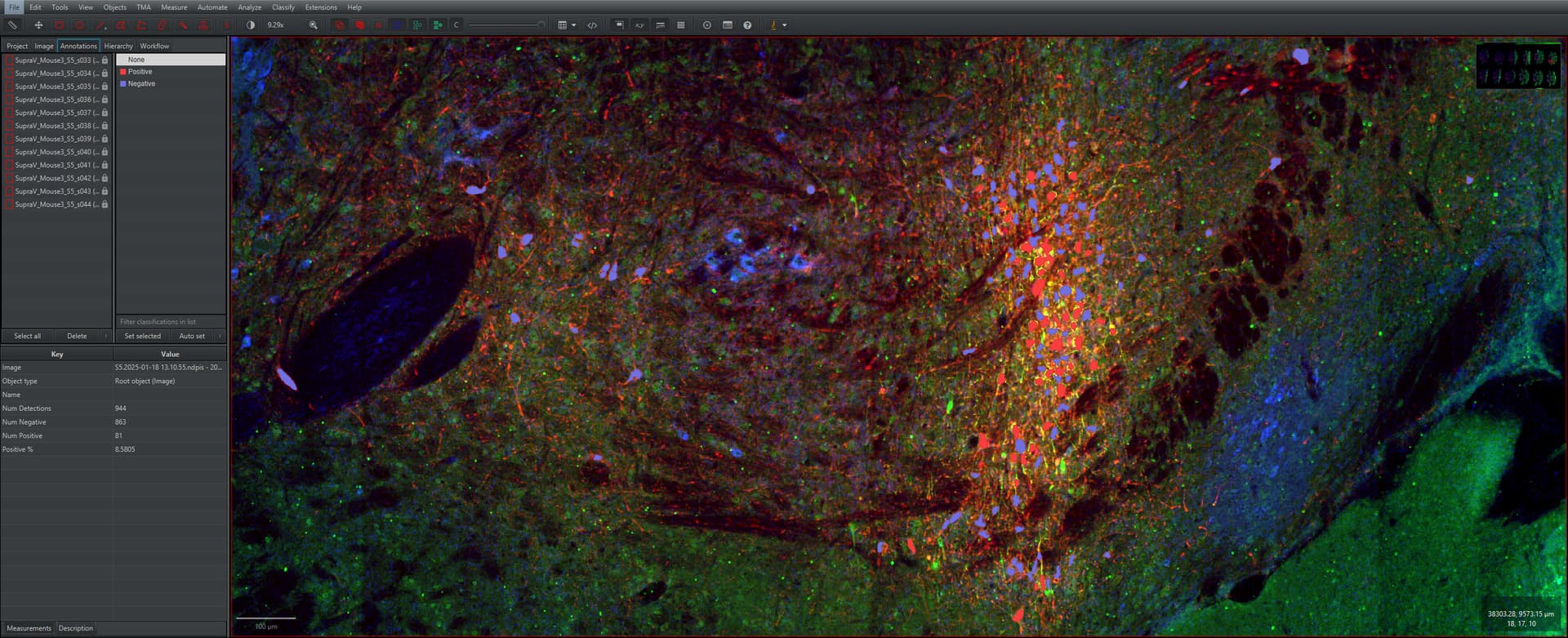 Batch render and export of annotated regions of slidescanner image - Usage & Issues - Image.sc Forum