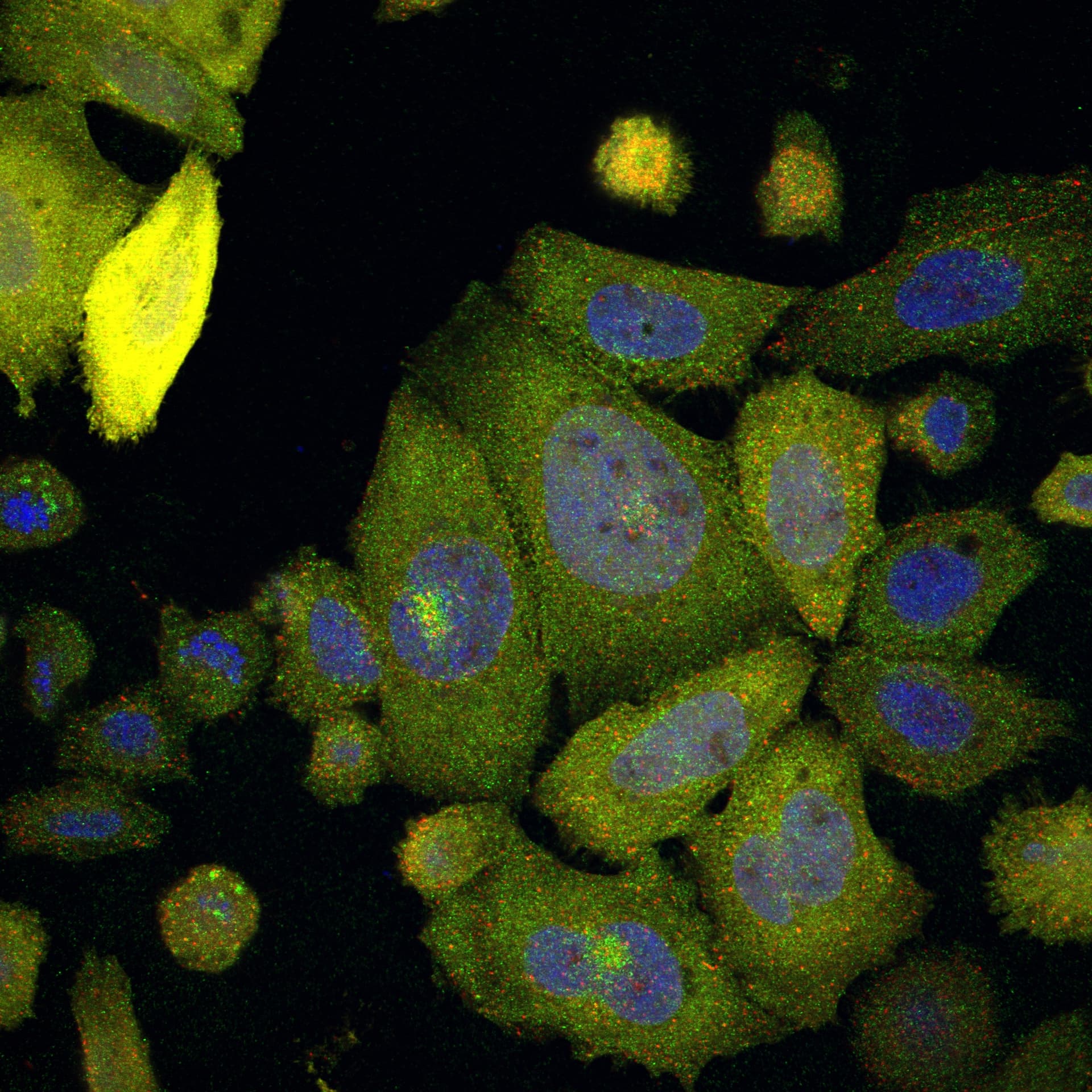 Cellpose segment cells of very large diameter (300) is slow - Usage & Issues - Image.sc Forum
