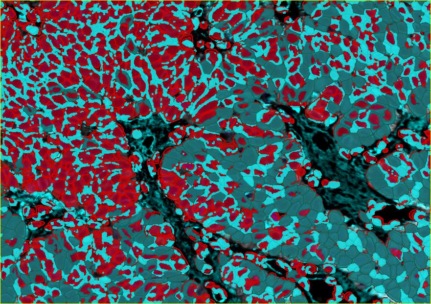 Creating a script to generate 'Membranous' 'Intracellular' & 'Ubiquitous' classes from the ...