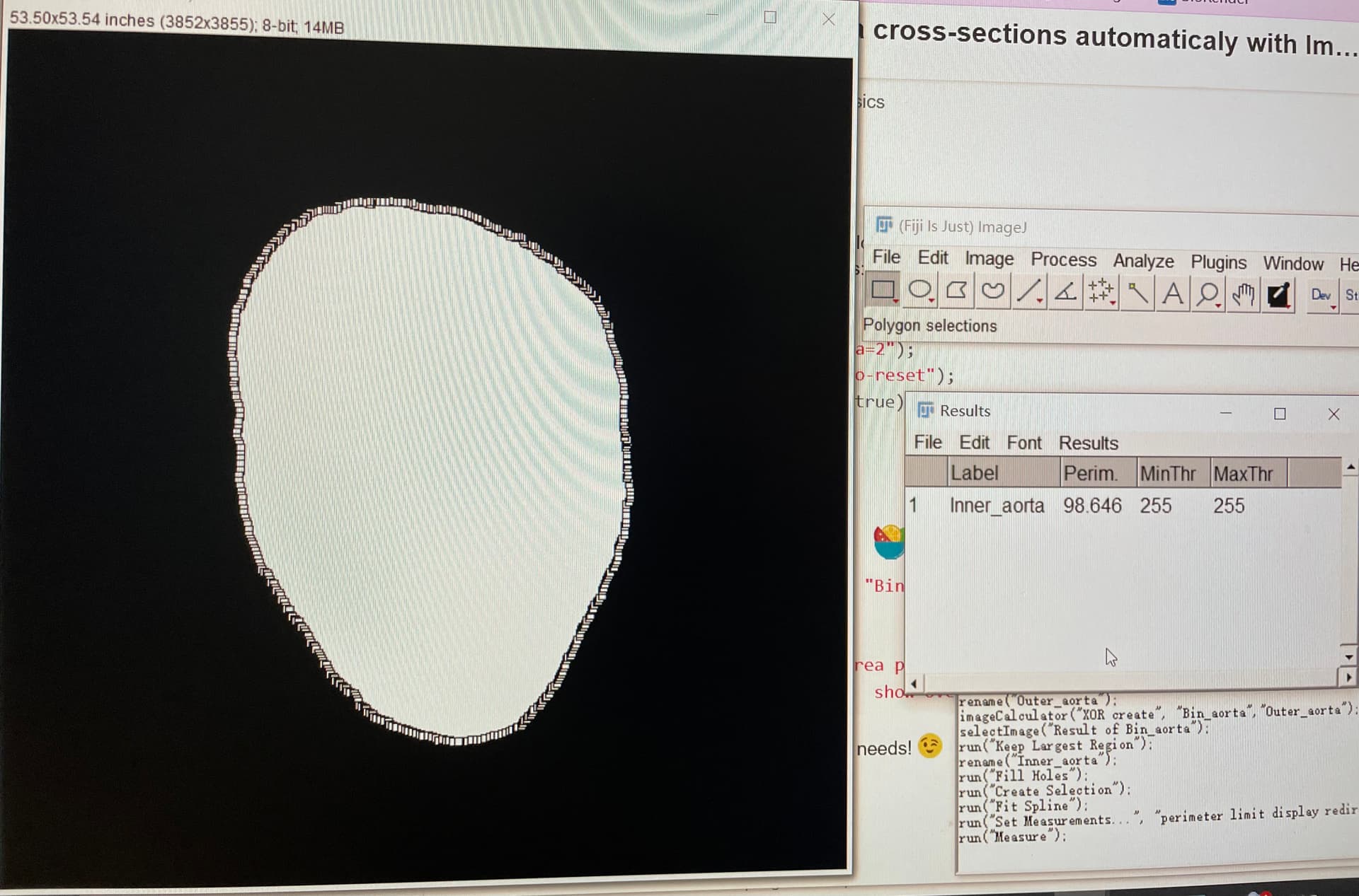 How to measure the inner perimeter of aorta cross-sections automaticaly with ImageJ - Image ...