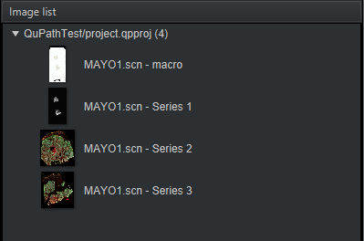 Opening multi-image Aperio .scn files - Usage & Issues - Image.sc Forum