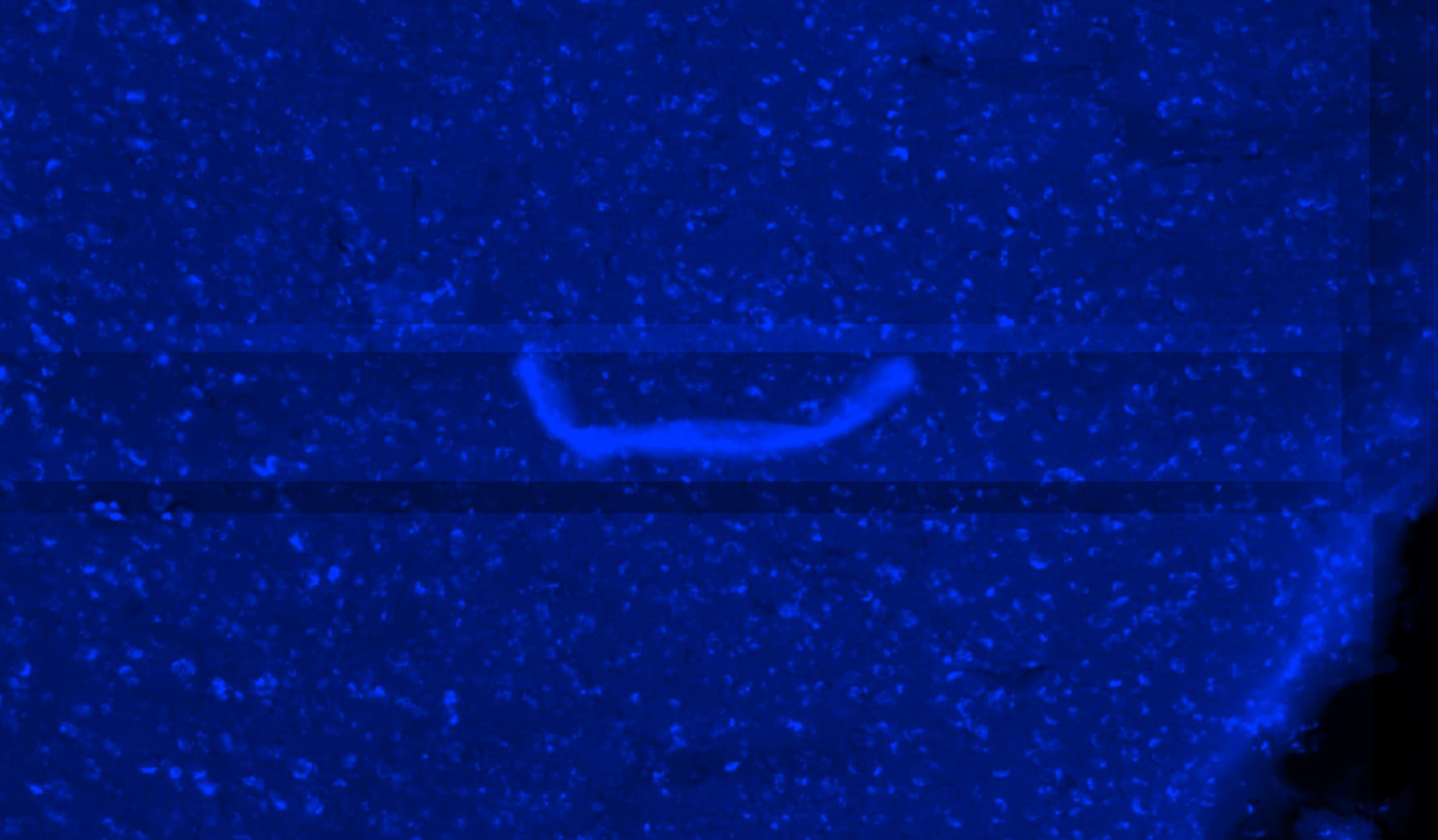 Shading correction problem on QuPath - Image Analysis - Image.sc Forum