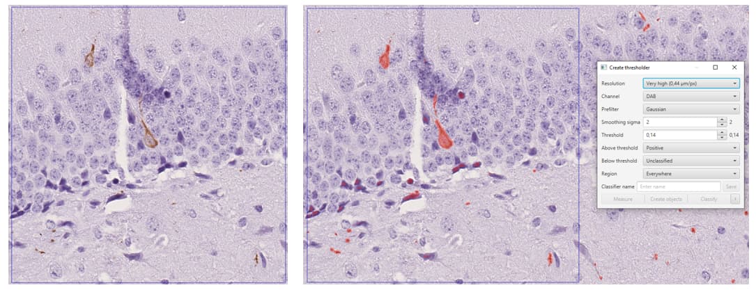 Trouble Using Pixel Classifier Applied To Annotations Image Analysis