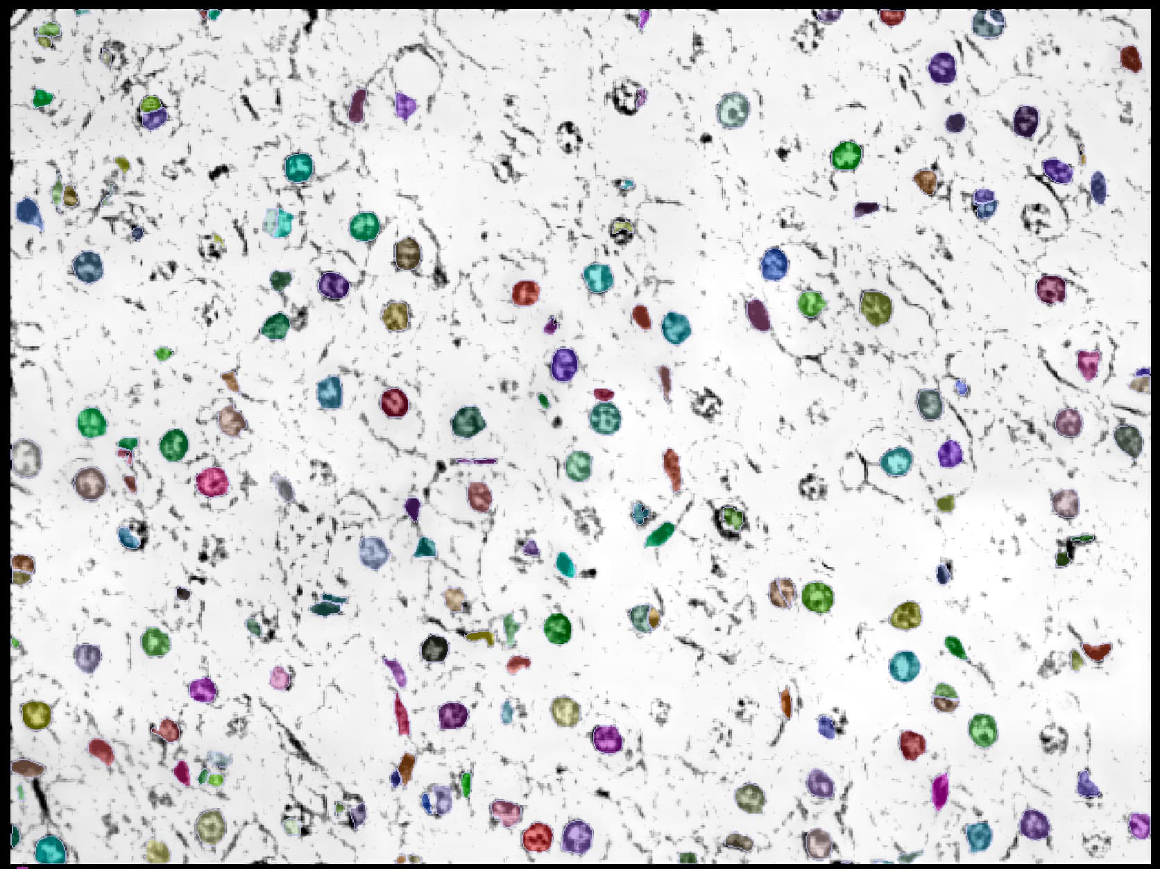 Enhancing and Identifying Nuclei (H&E stain) - Image Analysis - Image.sc Forum