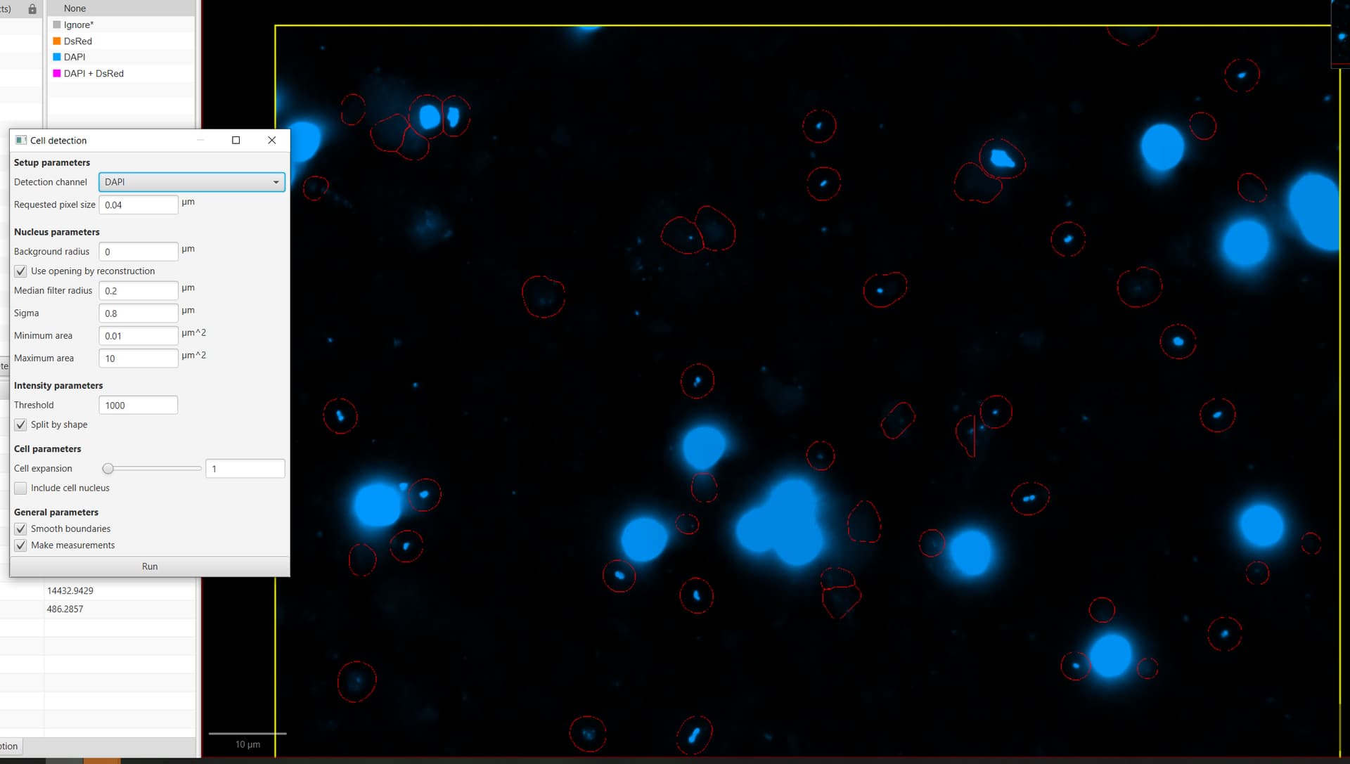 Cell detection issues in Qupath - Image Analysis - Image.sc Forum