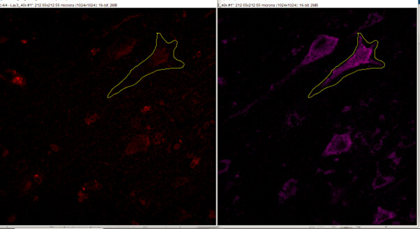 Meanders' coefficient for colocalization, tM1 or M1 value? - Image Analysis - Image.sc Forum