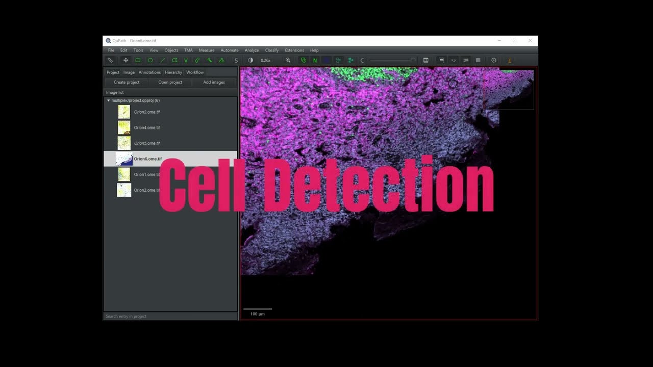 Cell Detection Parameters - What are each of the settings and suggestions on what we can do for ...