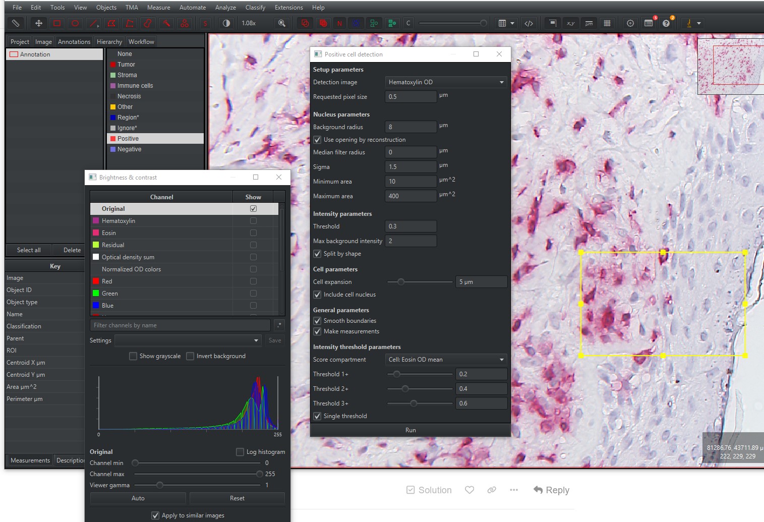 Qupath Error When Trying To Count Positive Cells Usage And Issues