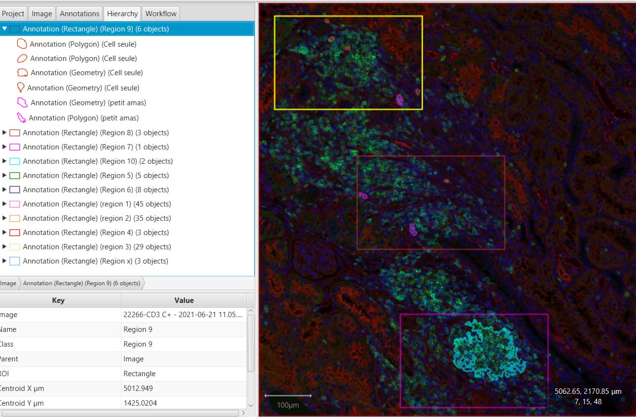 Qupath Script to Export Tiff with Annotation by sending region to ImageJ - Image Analysis ...