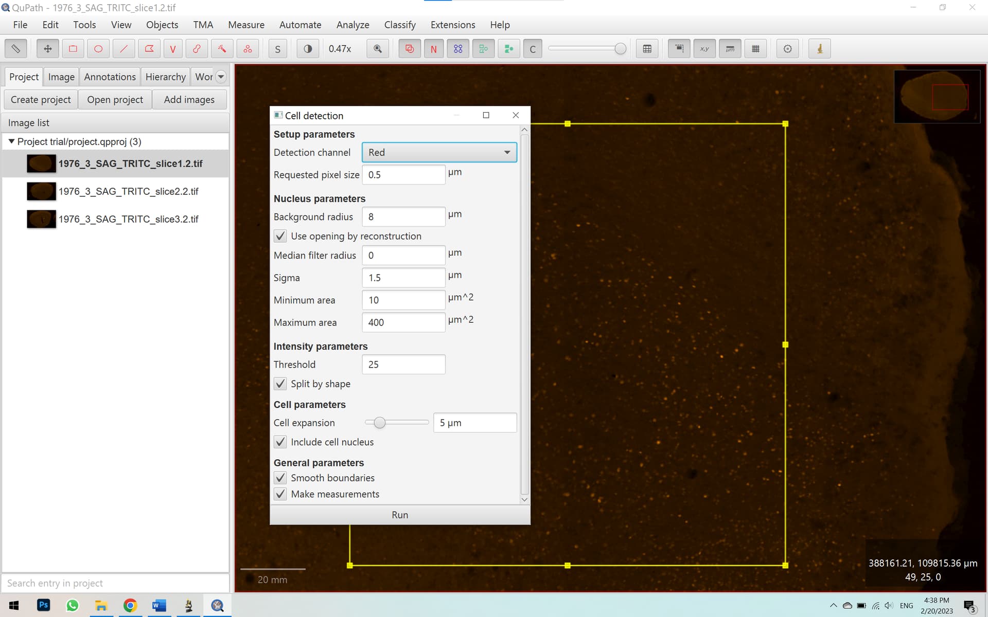 Analyze Cfos Marker In Qupath Image Analysis Image Sc Forum