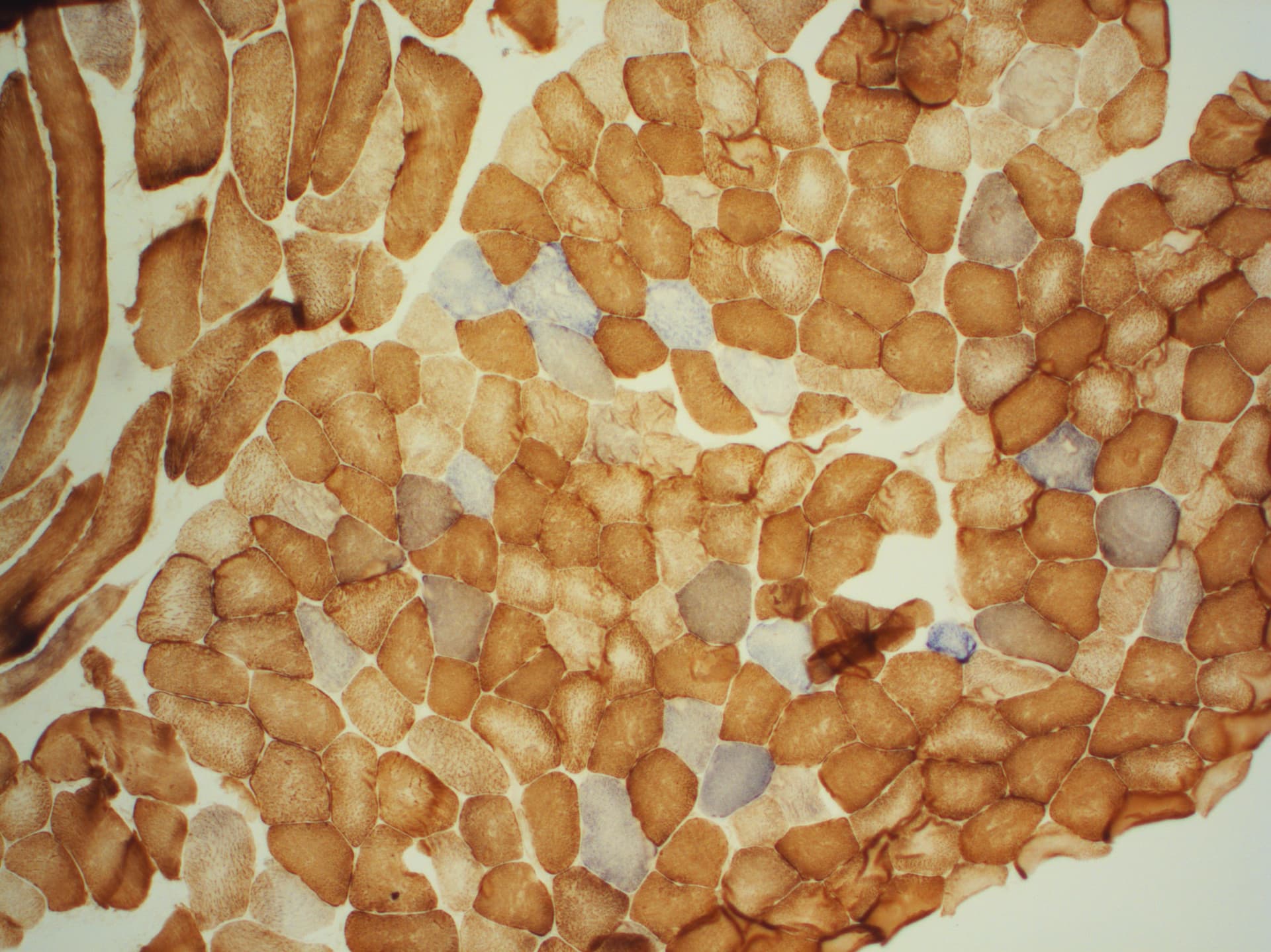 Help with IdentifyPrimaryObjects in mouse muscle tissue - Image ...