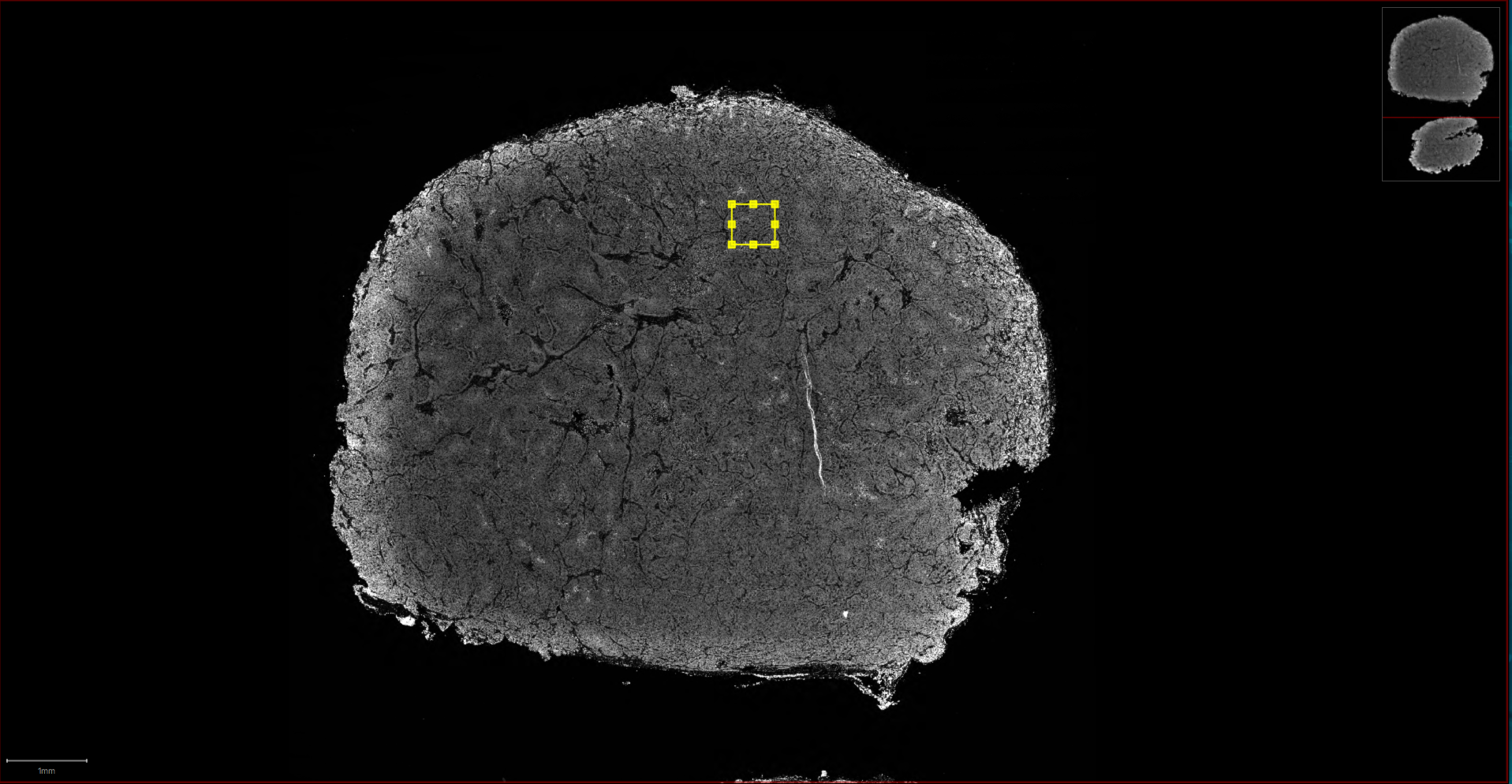 Help writing script with QuPath - Image Analysis - Image.sc Forum