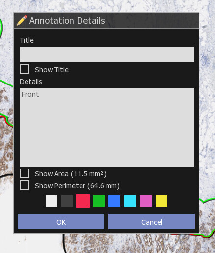 Exporting NDPI.NDPA annotation files from QuPath (code attached) - Page 2 - Development - Image ...