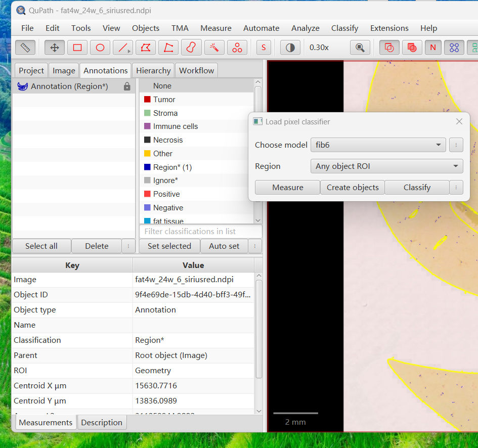 Requesting help for newcomers to solve the problem of computer lag when using qupath - Usage ...