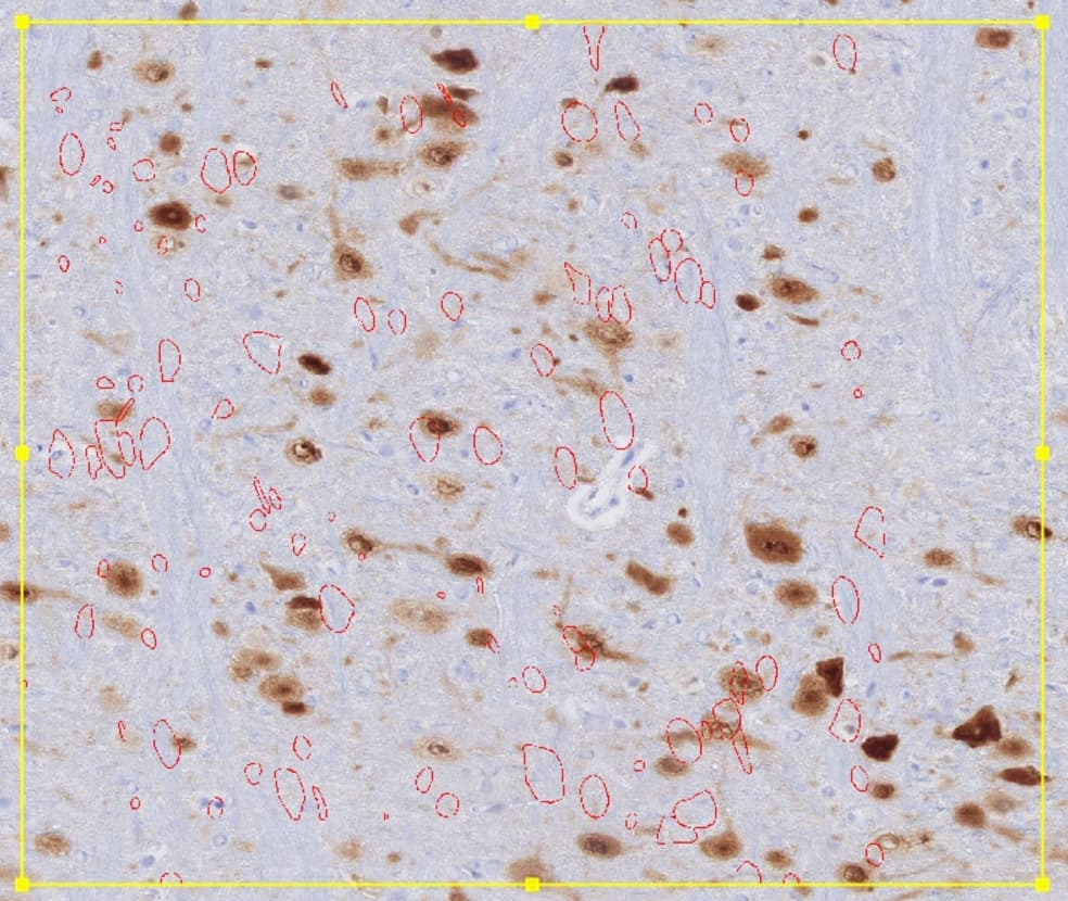 Does Cellpose4 (Cellpose-SAM) work with QuPath & Fiji wrappers? - Usage & Issues - Image.sc Forum