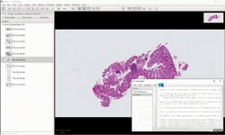 NoCodeSeg: Deep learning based segmentation without code (Qupath/DeepMIB/FastPathology) - Image ...