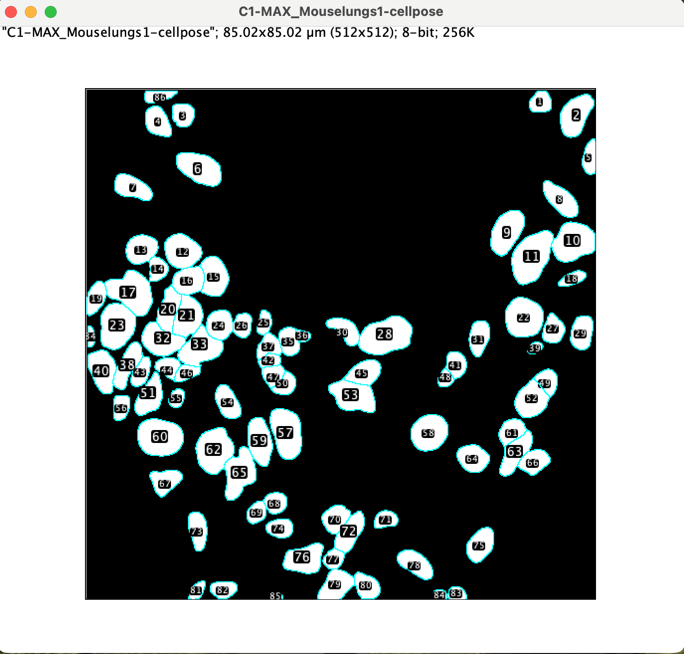 Help with Nuclear segmentation of Mouse lungs Using Fiji/CellProfiler - Image Analysis - Image ...
