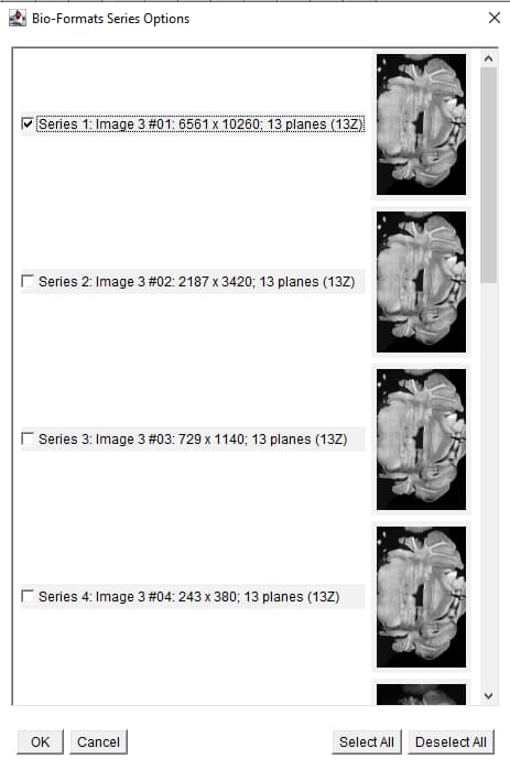 When importing z-stacks in Fiji I get wrong image size - Usage & Issues - Image.sc Forum