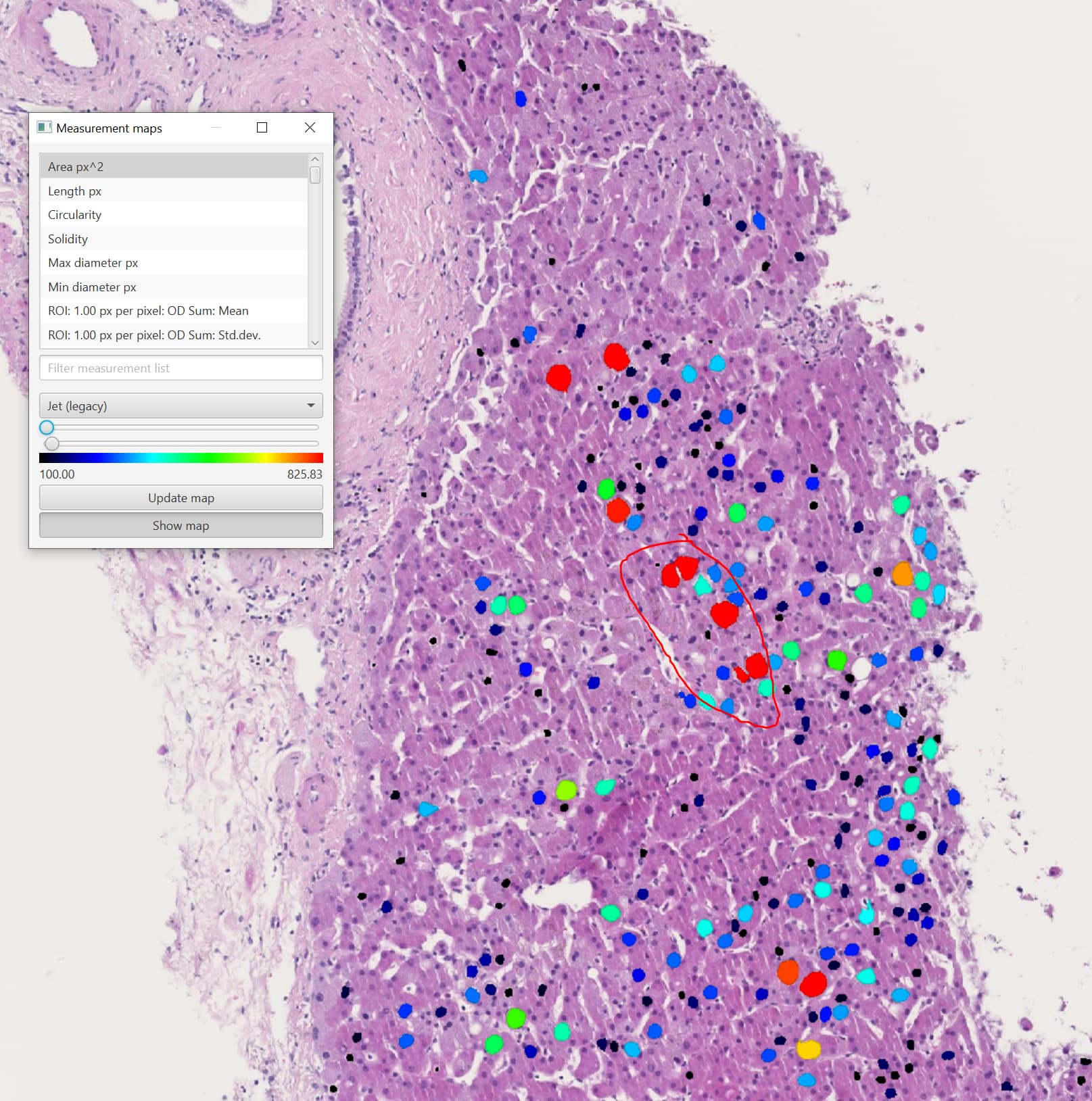 Measuring fat droplets in H&E tissue - ImageJ - Image Analysis - Image.sc Forum